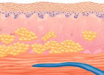 Ointments: Preparation & Evaluation of Drug Release: Labs | Pharmlabs