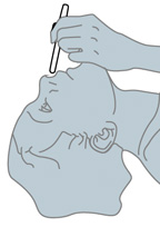 Intranasal Preparations | Pharmlabs